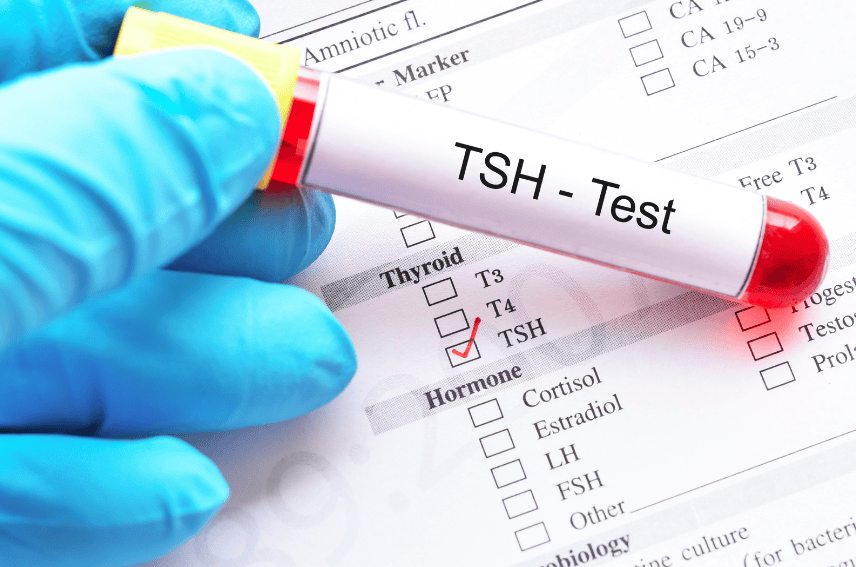 Thyroid Testing: Importance and What to Know